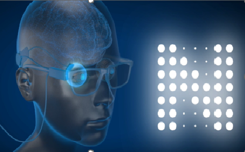 Barrett Formulas on the AL-Scan Viewer for NAVIS-EX ｜ NIDEK