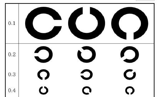 NIDEK launches the GS Viewer for NAVIS-EX ｜ NIDEK