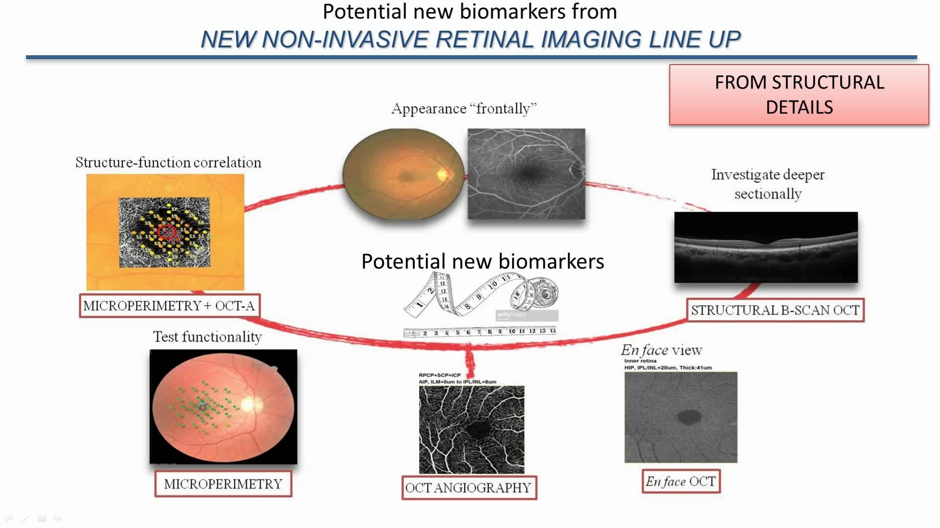 Microperimeter MP-3 ｜ NIDEK