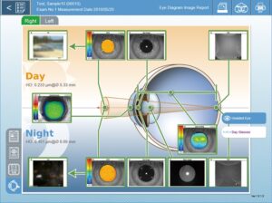 Refractive Power / Corneal Analyzer OPD-Scan III ｜ NIDEK