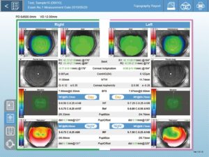 Refractive Power / Corneal Analyzer OPD-Scan III ｜ NIDEK