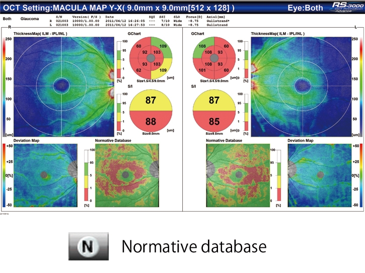 Software for NIDEK OCT series Long Axial Length Normative Database ｜ NIDEK