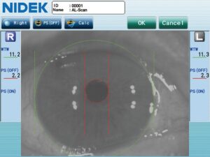 Optical Biometer AL-Scan ｜ NIDEK